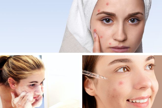 Top 15 sữa rửa mặt cho da dầu mụn tuổi dậy thì tốt nhất